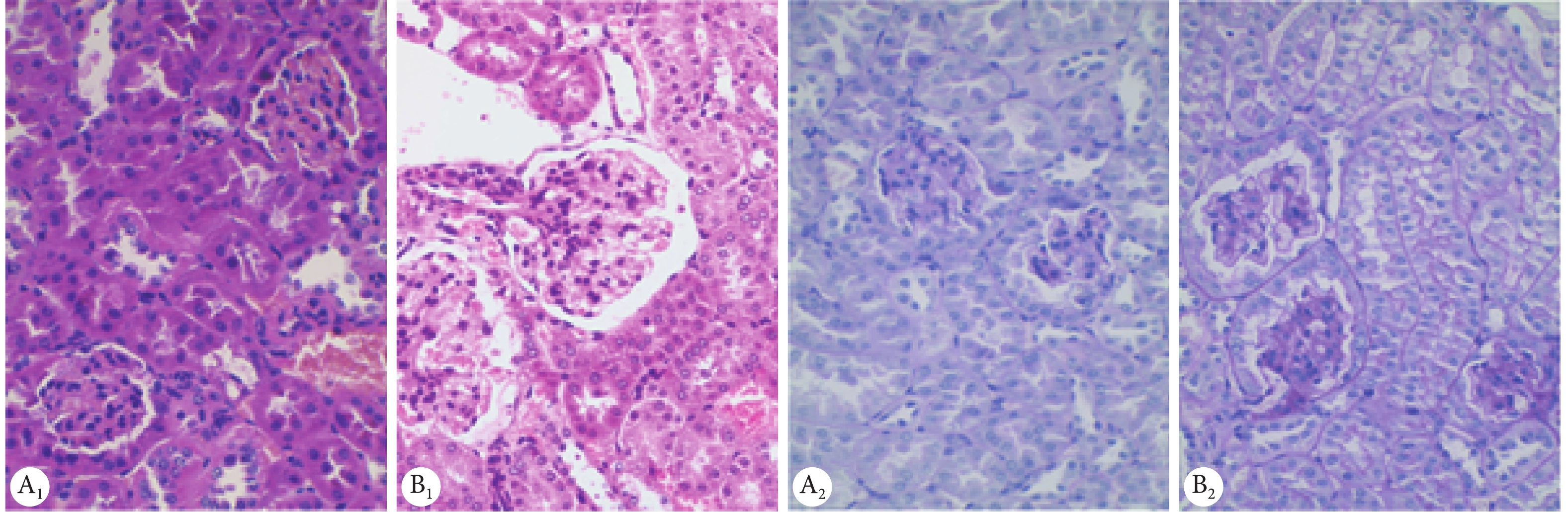 Lepr db / db 小鼠肾损伤机制探讨