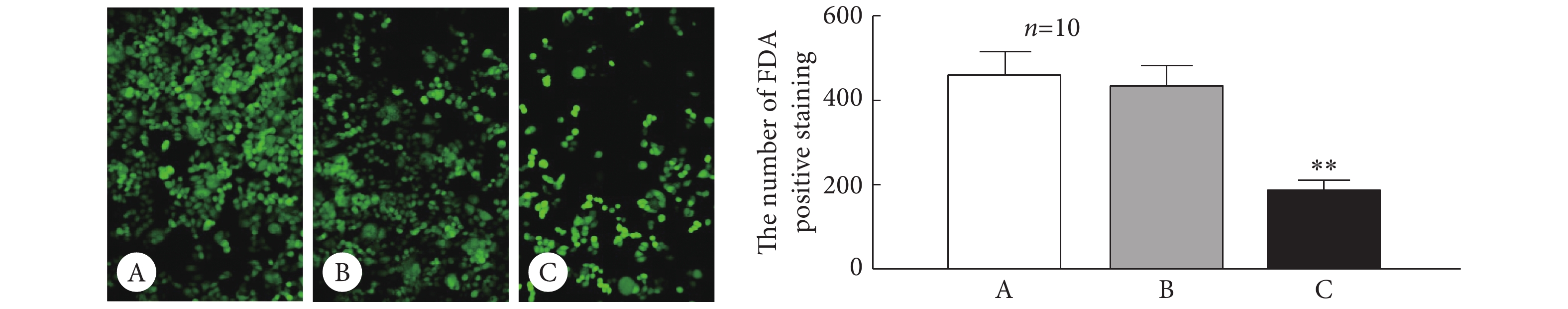 沉默 FMOD 对H322细胞的增殖和迁移的影响及其作用机制探讨