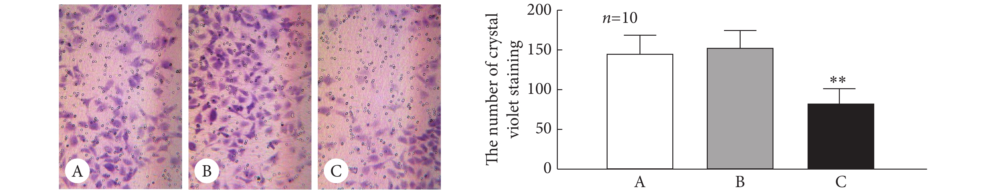 沉默 FMOD 对H322细胞的增殖和迁移的影响及其作用机制探讨