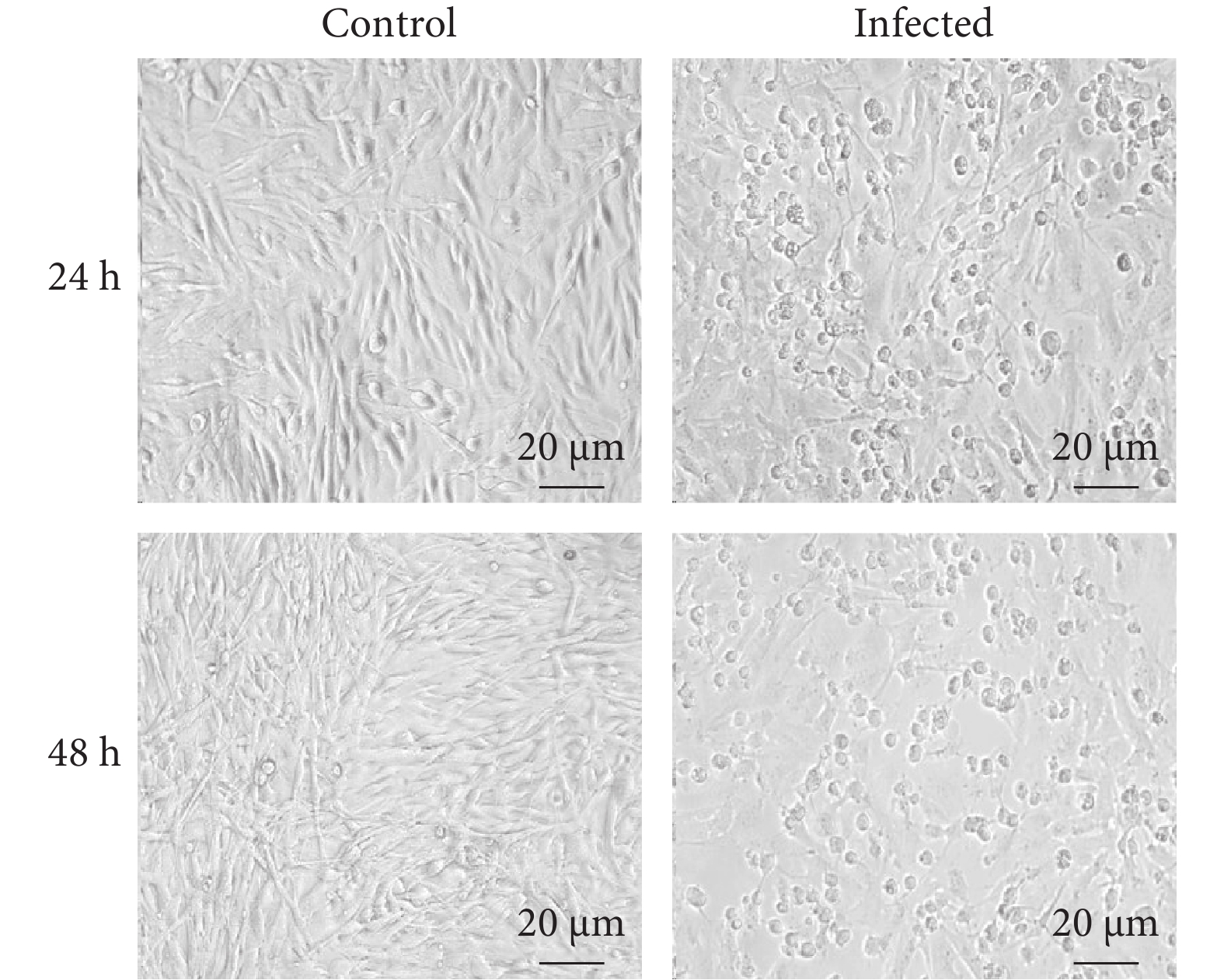 Effects of Enterovirus 71 on Mitochondrial Dynamics in Human Glioma ...
