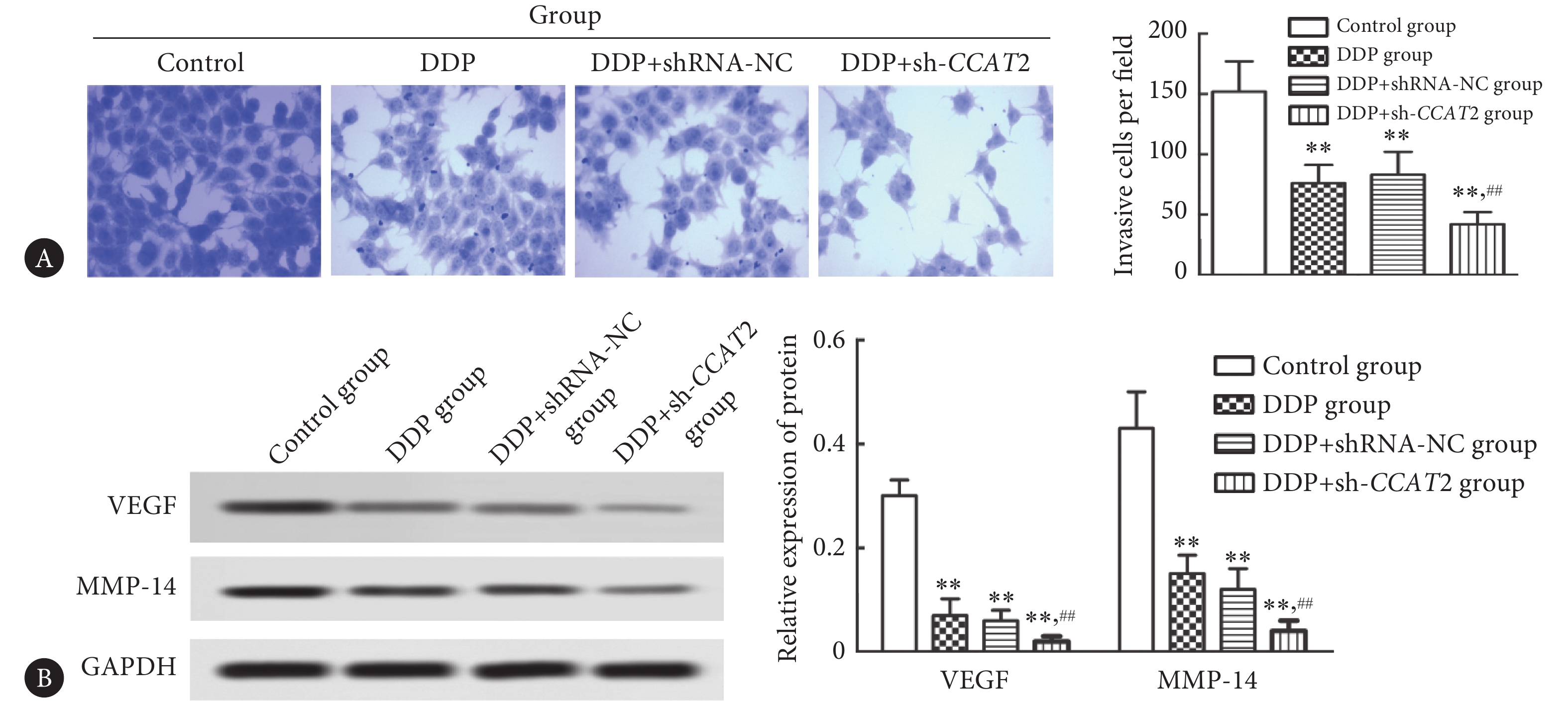 shRNA沉默 CCAT 2对非小细胞肺癌耐顺铂细胞A549的影响