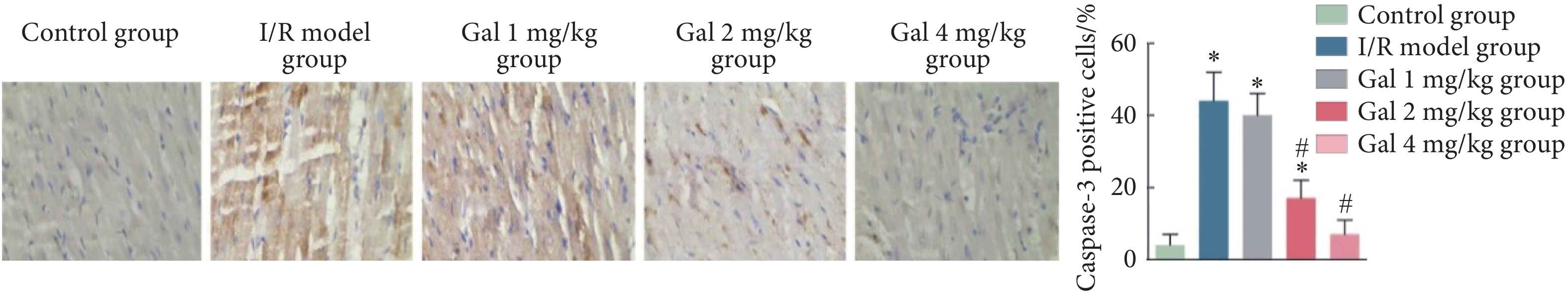 氢溴酸加兰他敏介导AMPKα1/Nrf2/HO-1通路对大鼠心肌缺血再灌注损伤的保护作用