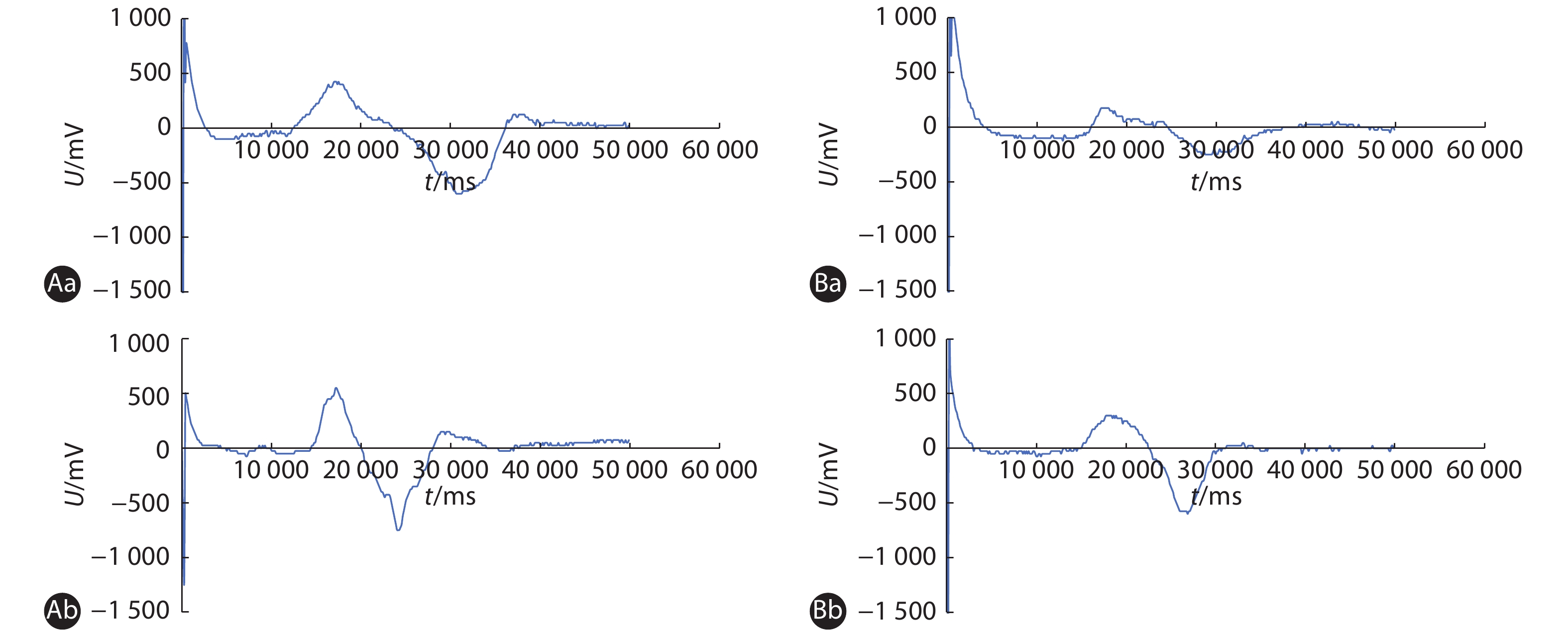 rTMS刺激运动前区改善脊髓损伤后肌张力障碍1例报告