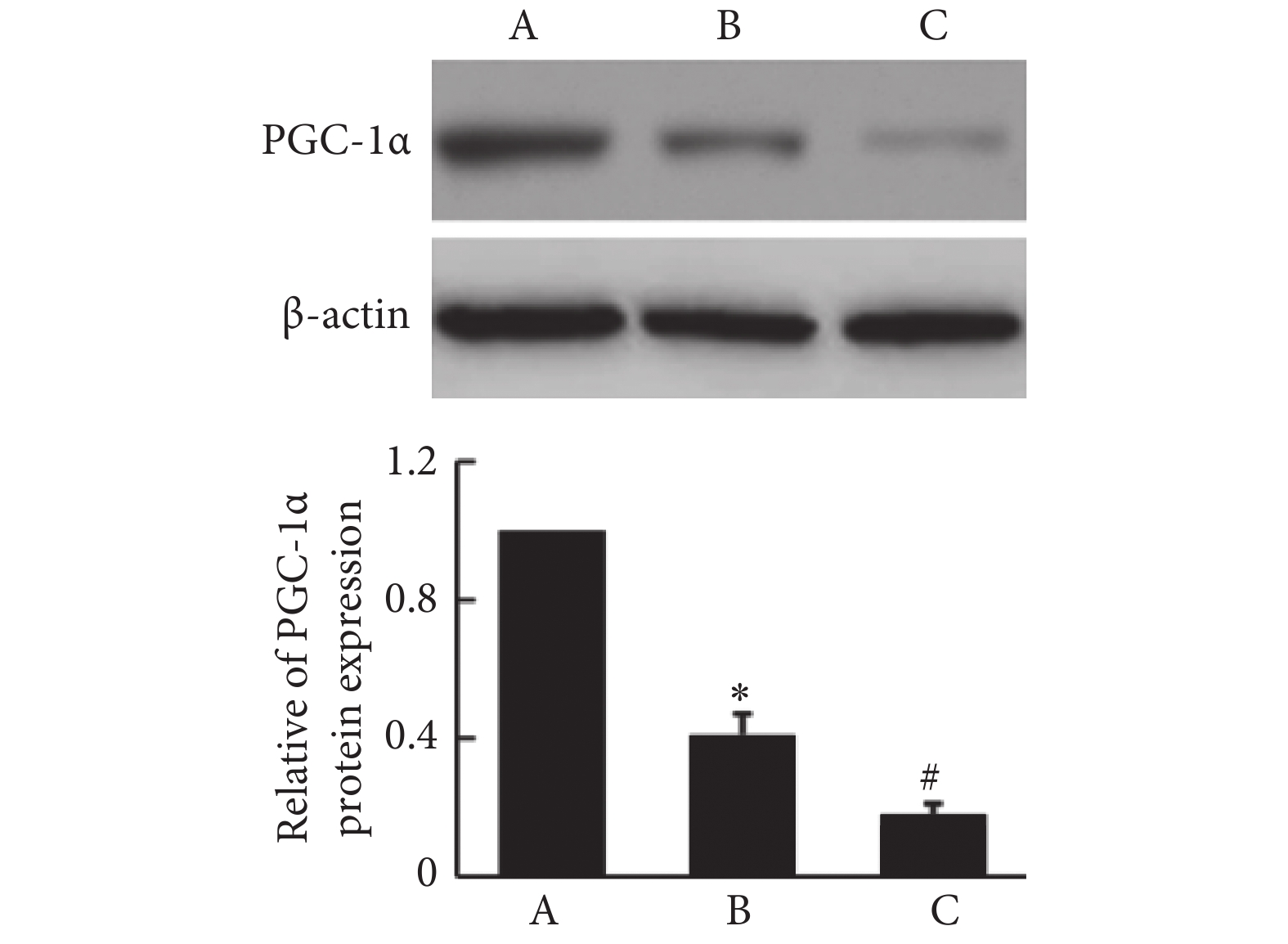 PGC-1ɑ在多囊卵巢综合征模型大鼠卵巢组织的表达变化