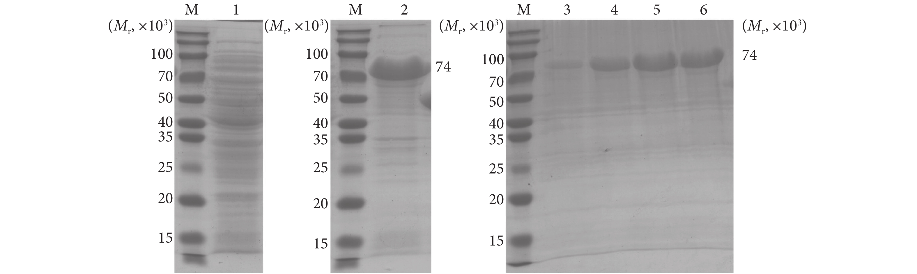 婴儿利什曼原虫 Pepck 和 Gp 63优势表位的真核与原核重组载体的构建与表达