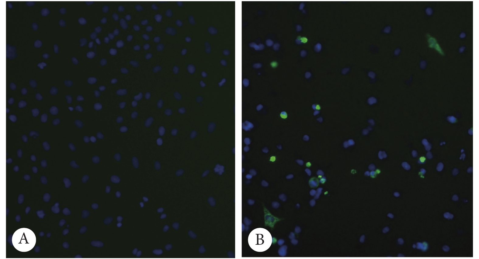 婴儿利什曼原虫 Pepck 和 Gp 63优势表位的真核与原核重组载体的构建与表达