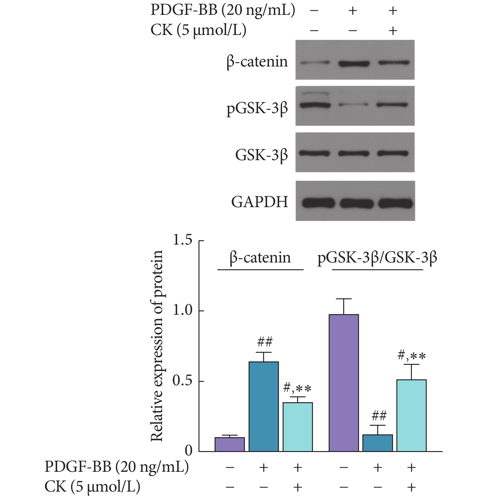 人参皂苷CK对PDGF-BB诱导的肺动脉平滑肌细胞增殖和表型转换的影响及机制