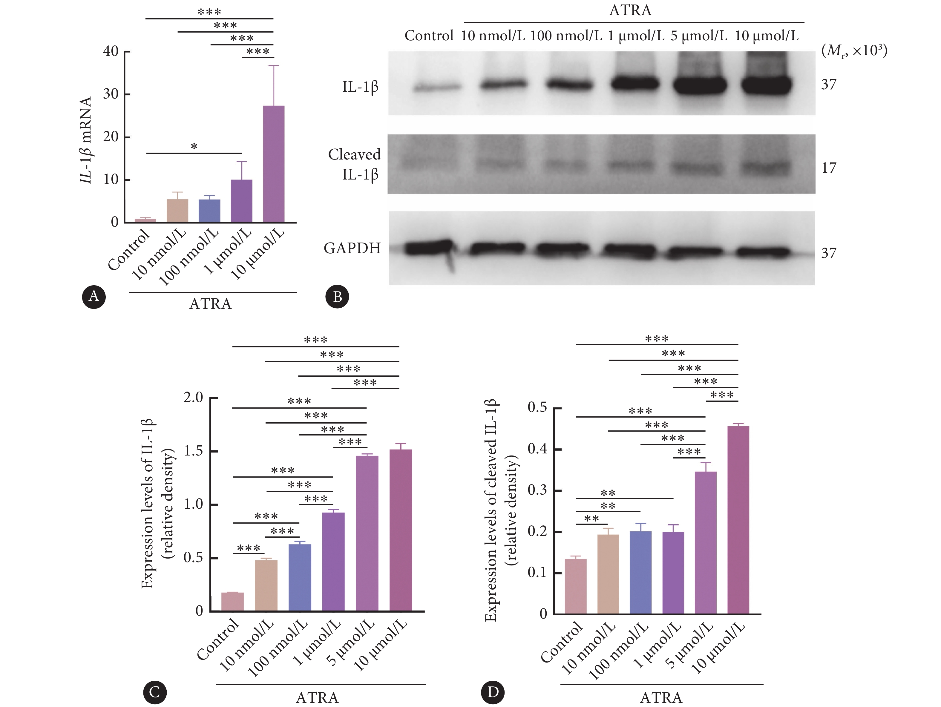 全反式维甲酸对巨噬细胞中白介素-1β表达的调控及机制研究
