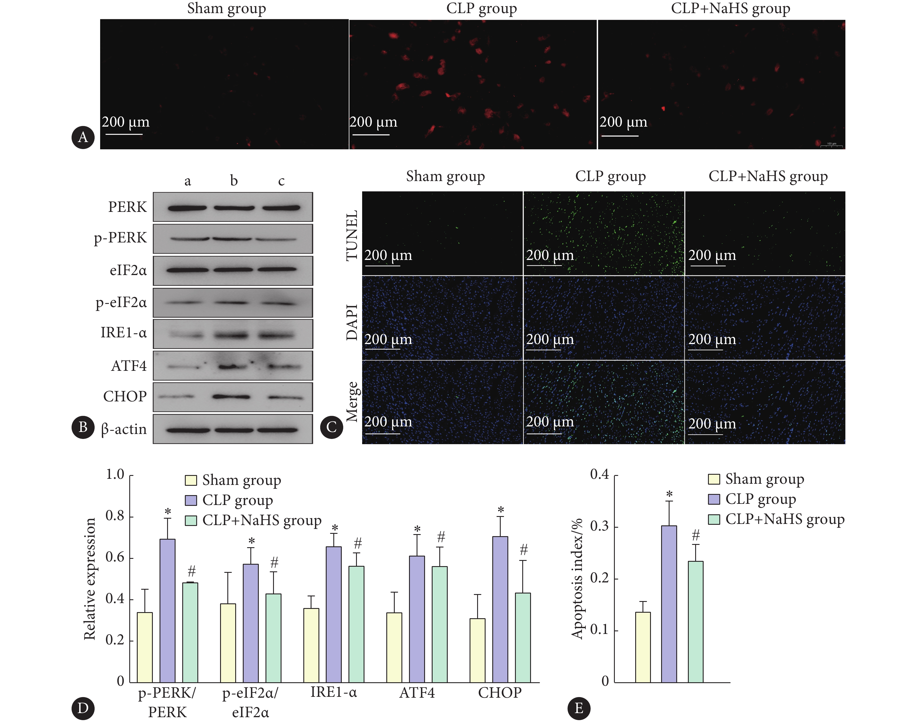 硫化氢通过抑制ROS介导的内质网应激改善脓毒症心肌损伤的研究