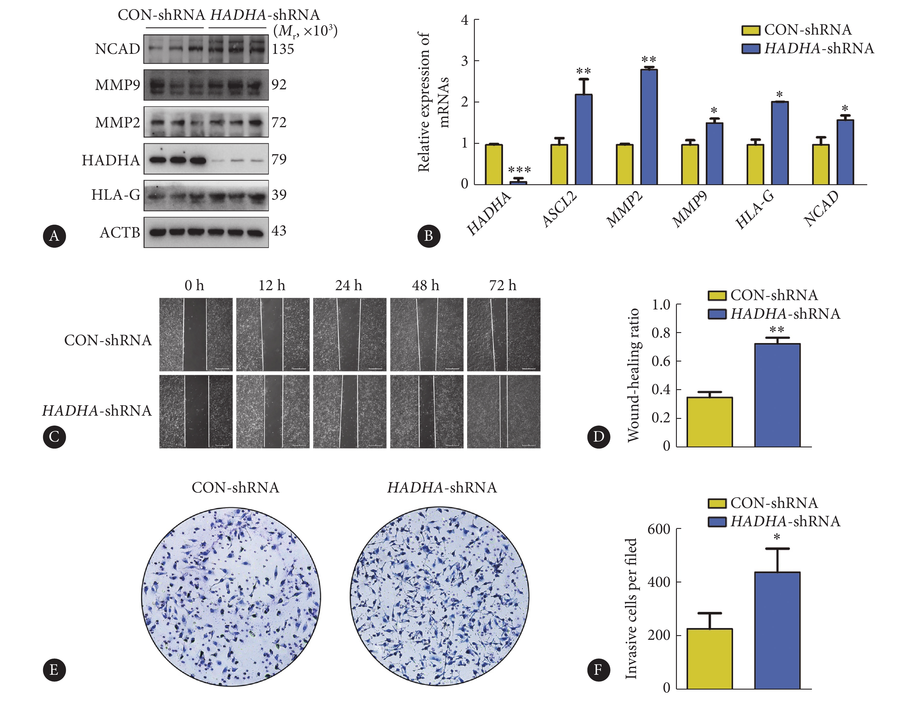 HADHA通过调节PI3K/AKT信号通路抑制人绒毛膜滋养细胞HTR-8/SVneo迁移与侵袭