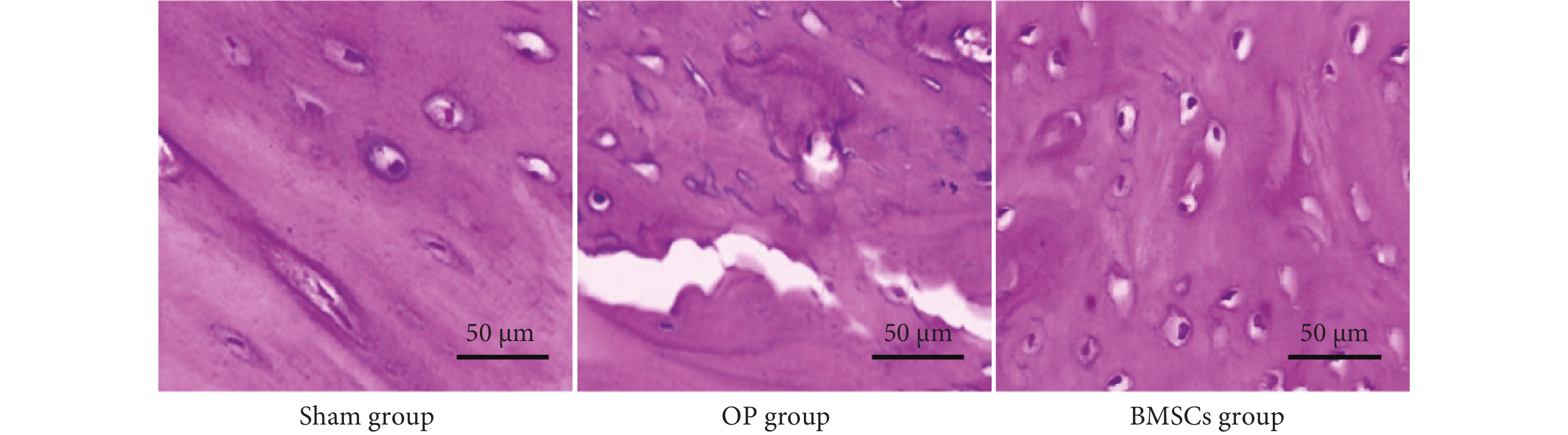 骨髓间充质干细胞对骨质疏松性椎体骨折大鼠力学动态及BALP/CTX-1表达的影响