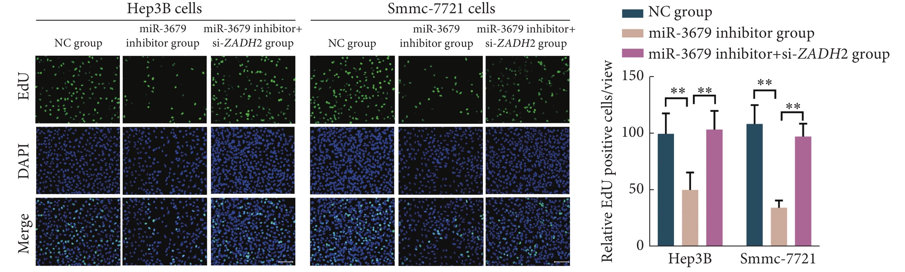 miRNA-3679抑制下游ZADH2-靶基因促进肝癌细胞增殖的机制研究