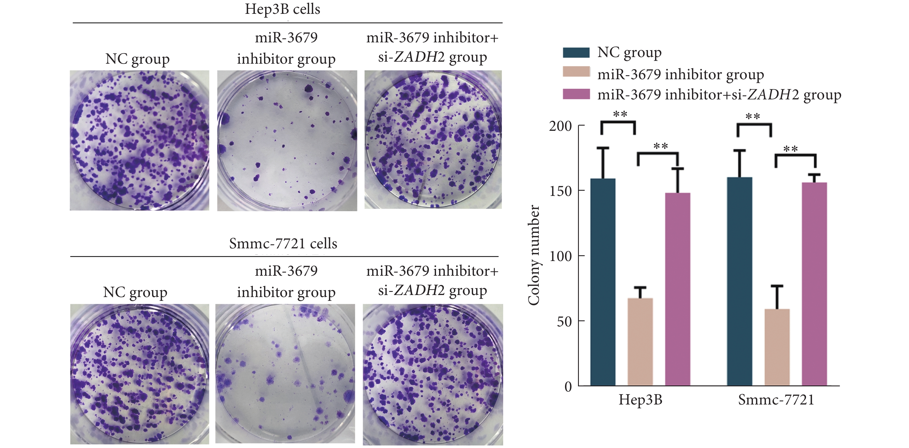 miRNA-3679抑制下游ZADH2-靶基因促进肝癌细胞增殖的机制研究