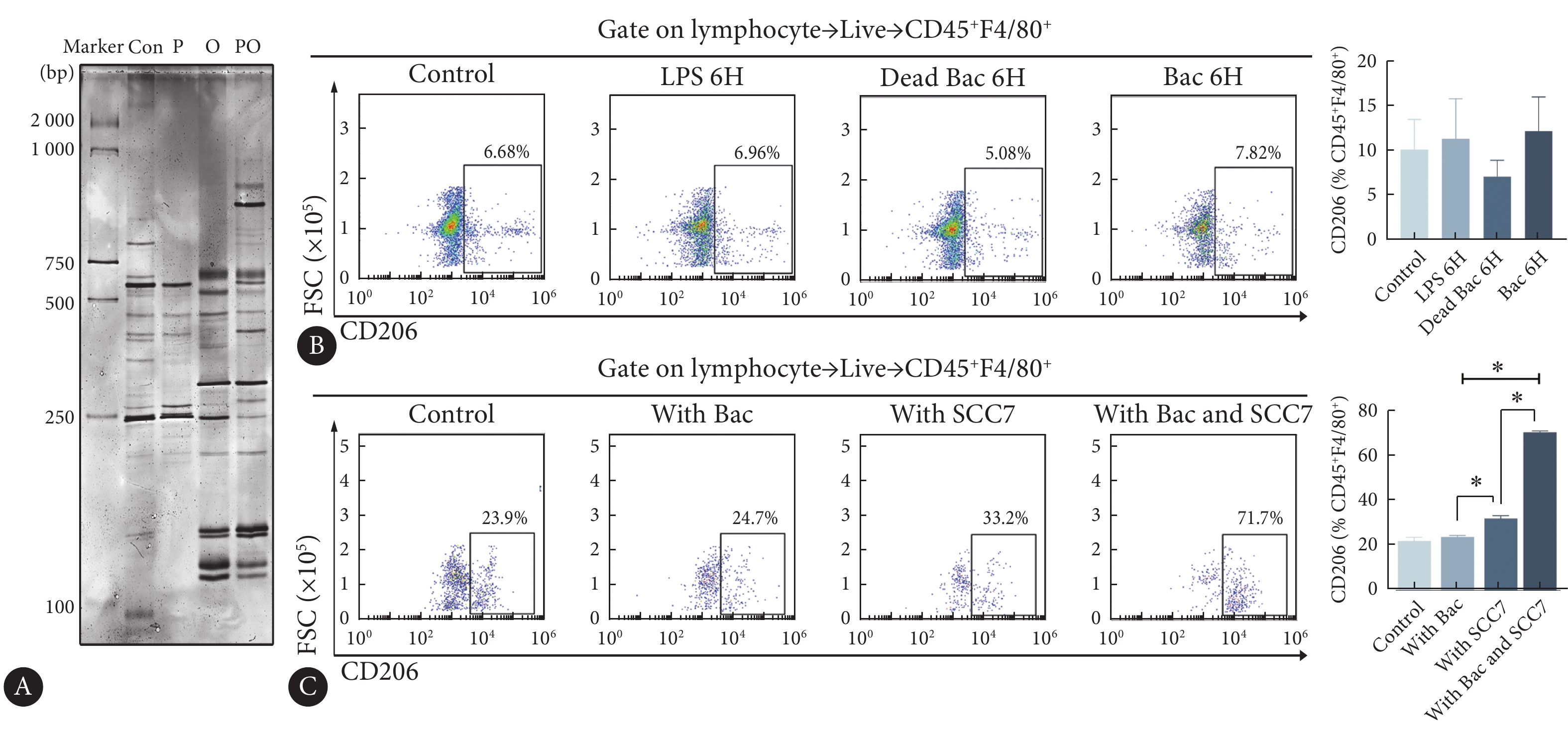 牙周炎诱导巨噬细胞M2极化促进口腔鳞状细胞癌进展