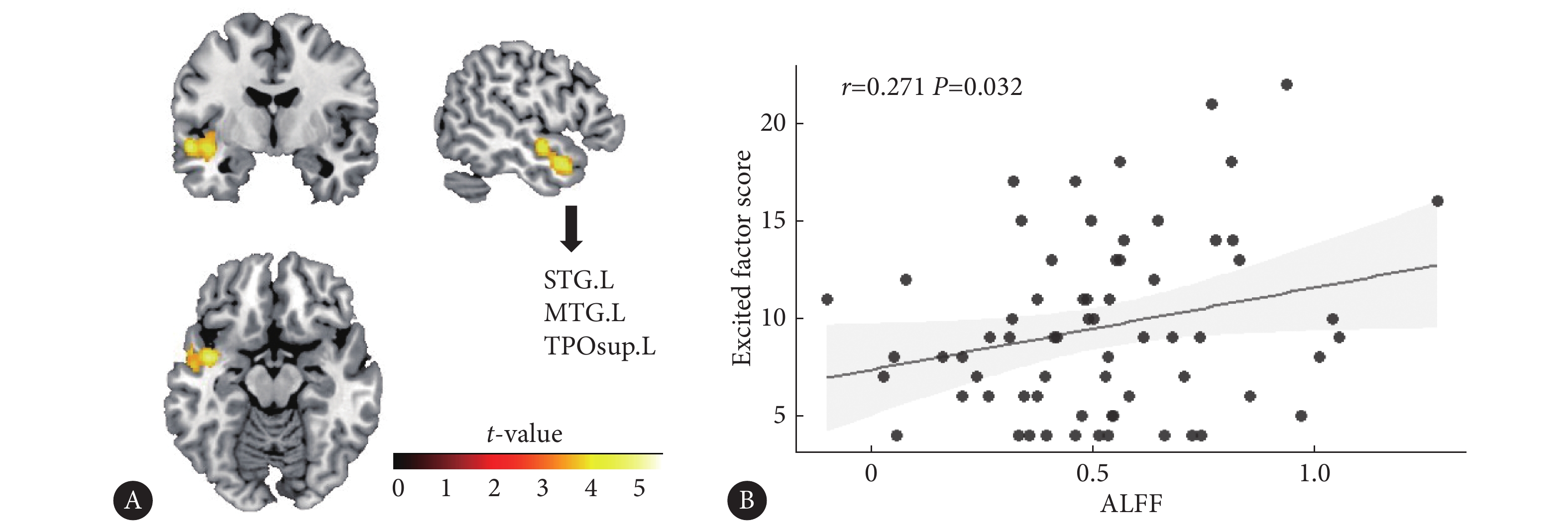 首发未服药精神分裂症患者自发脑活动的频率特异性改变