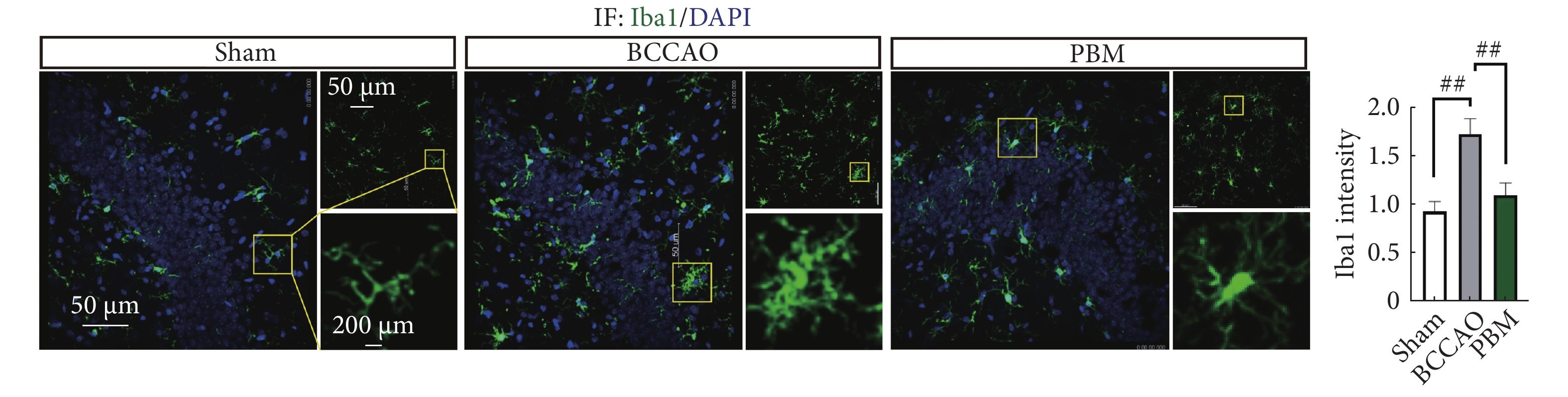 光生物调节促进慢性低灌注大鼠海马神经元再生改善认知功能及其抗炎症作用