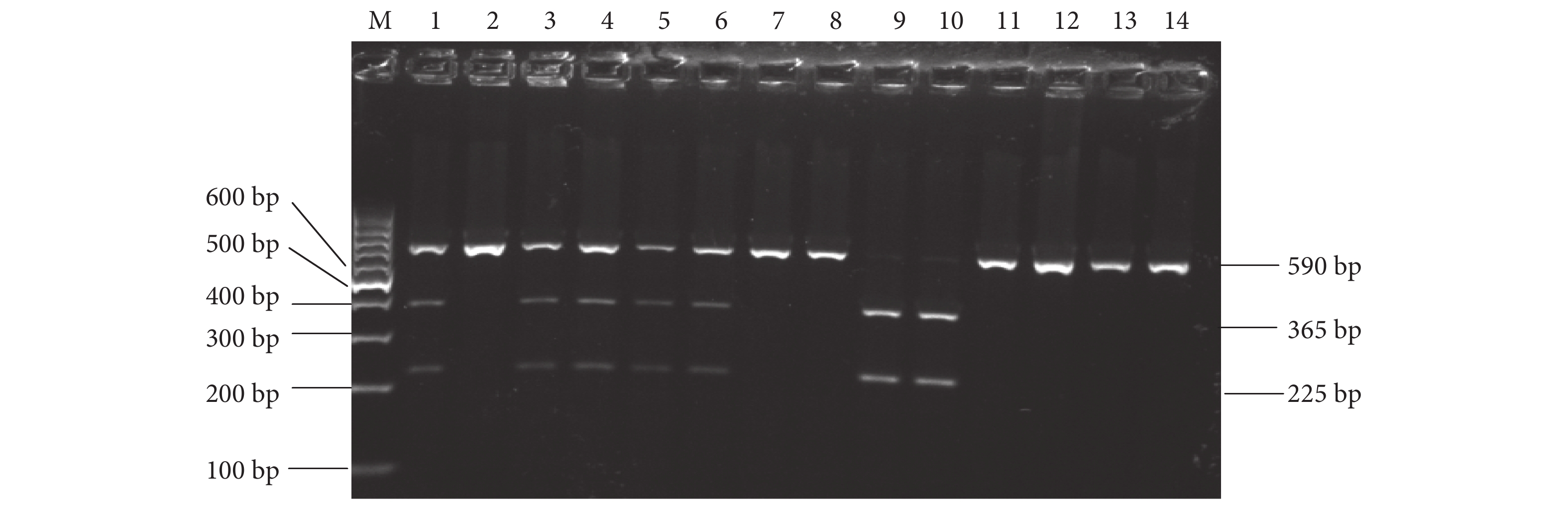 妊娠糖尿病载脂蛋白C3基因 Sst Ⅰ多态性与血脂关系的研究