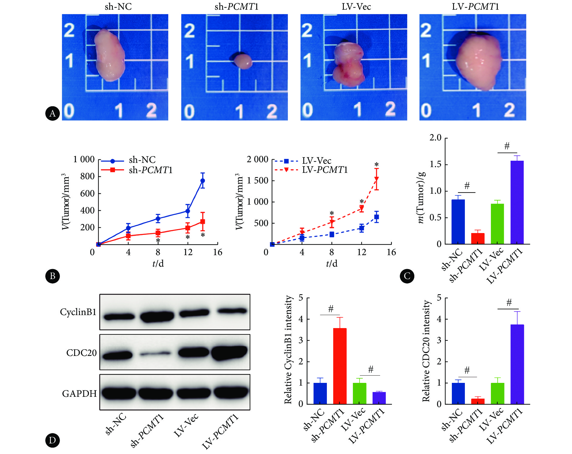 胃癌中PCMT1表达的预后价值及其对纺锤体组装检查点的调控作用
